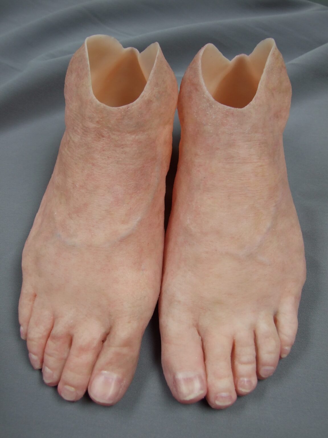 Quality Custom Silicone Foot and Toe Prosthetic