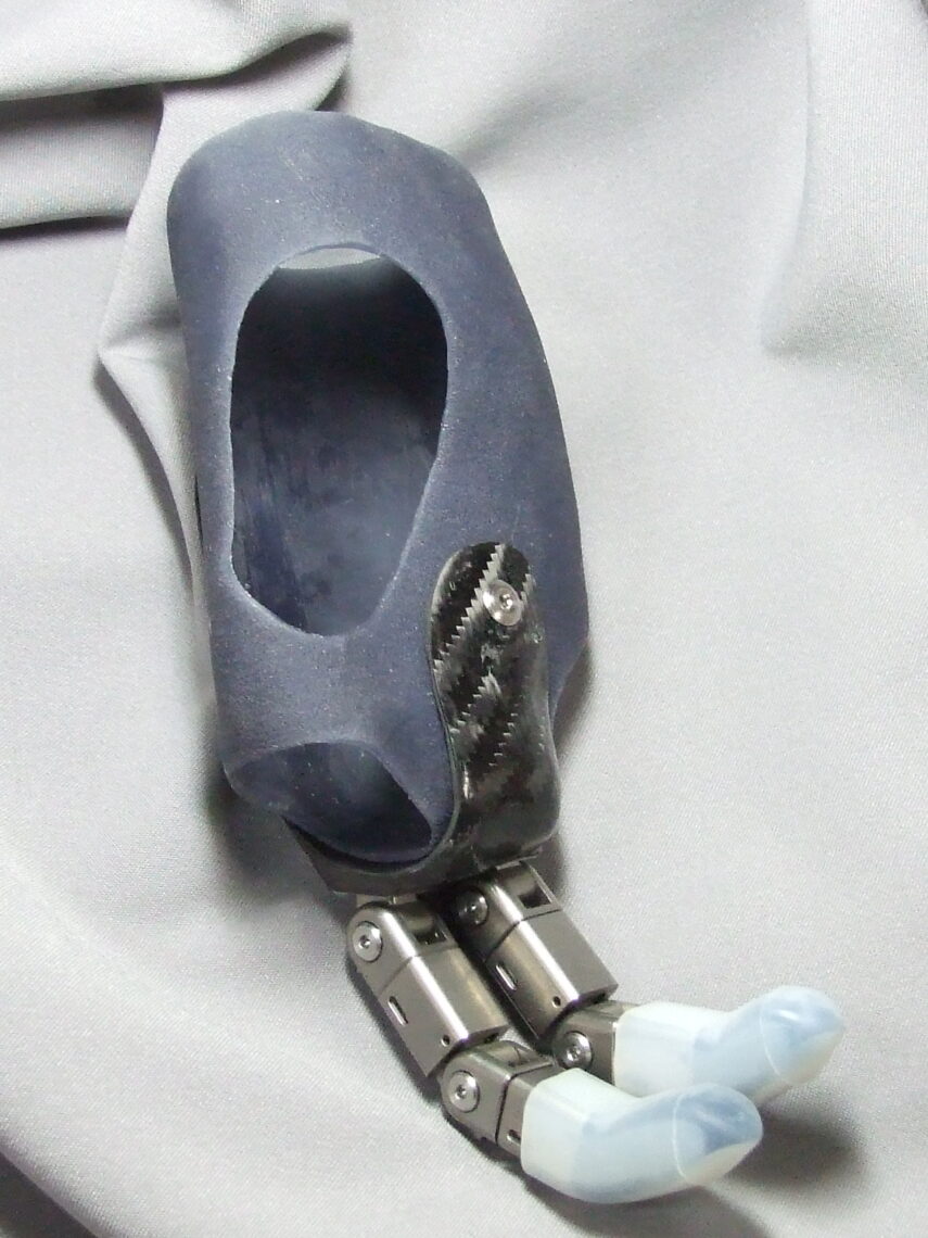 Prosthetic Hand